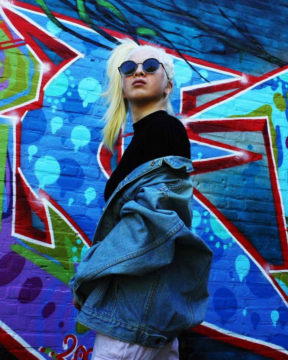 Abandoned As A Baby Due To Albinism, Xueli Grew Up To Become A Vogue ...