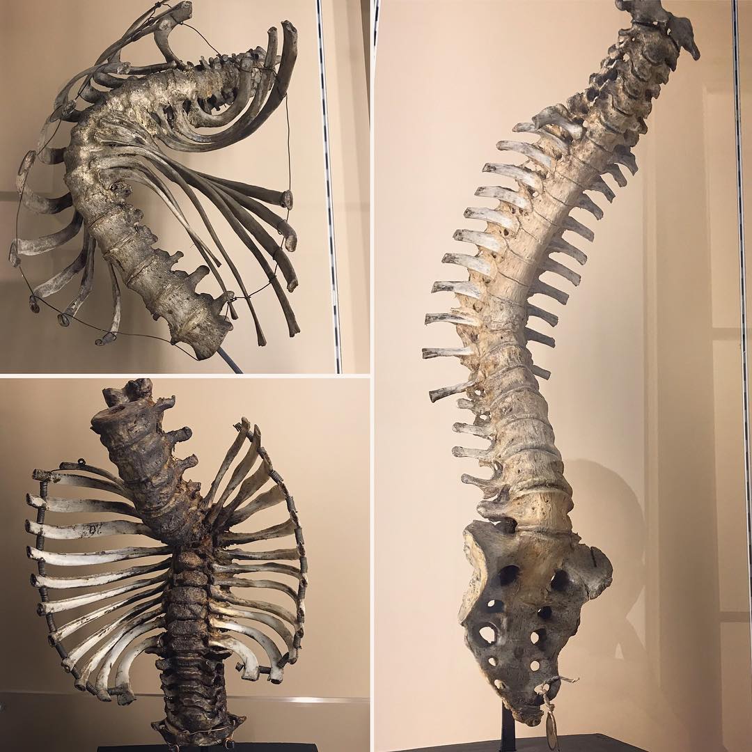 This Man Has a Damn Creepy Collection of Anatomical Exhibits » Design ...