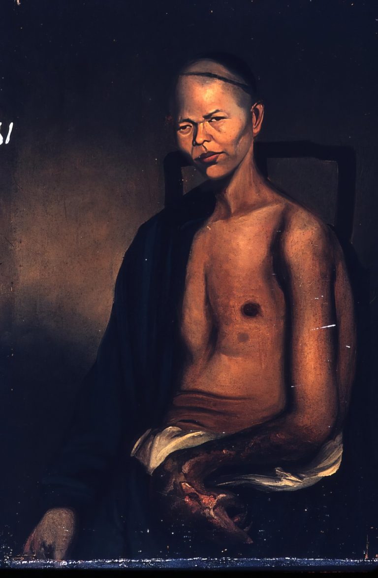 The Peter Parker Collection of Lam Qua ‘Tumor’ Bizarre Paintings ...