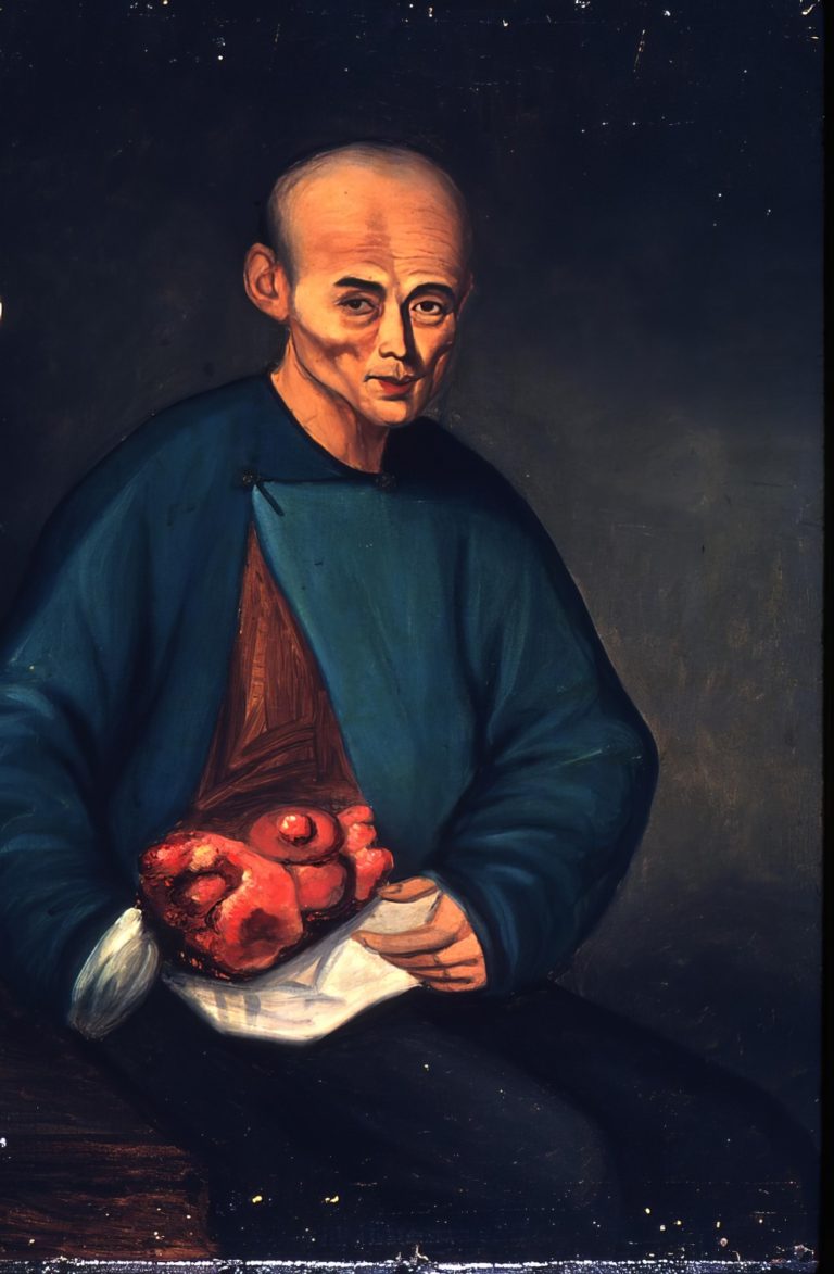 The Peter Parker Collection of Lam Qua ‘Tumor’ Bizarre Paintings ...