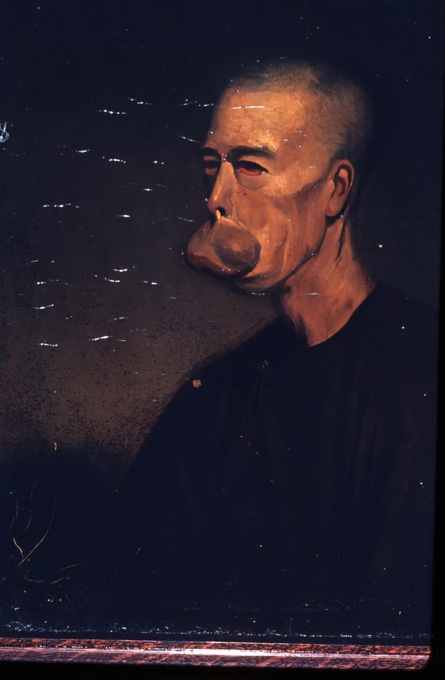 The Peter Parker Collection of Lam Qua ‘Tumor’ Bizarre Paintings ...